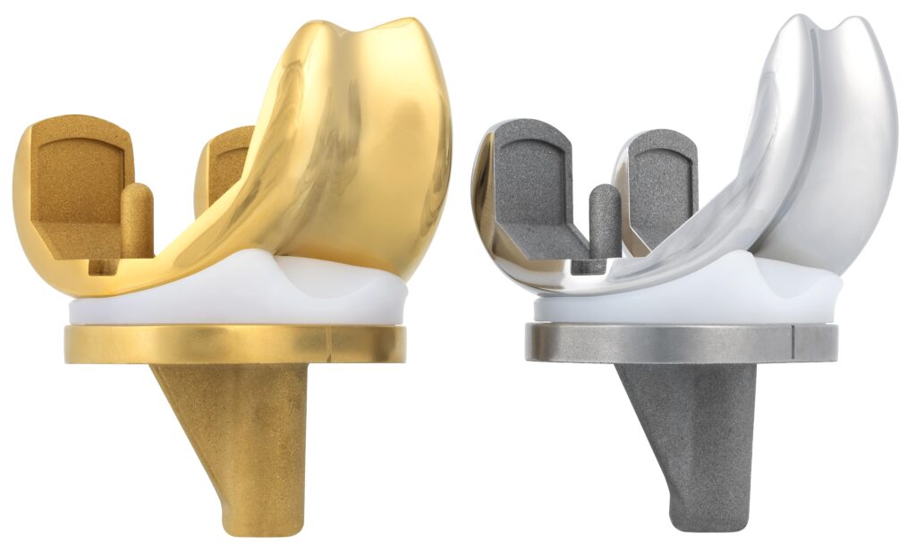 Maxx Orthopedics announces FDA 510(k) clearance of Medial Congruent ...